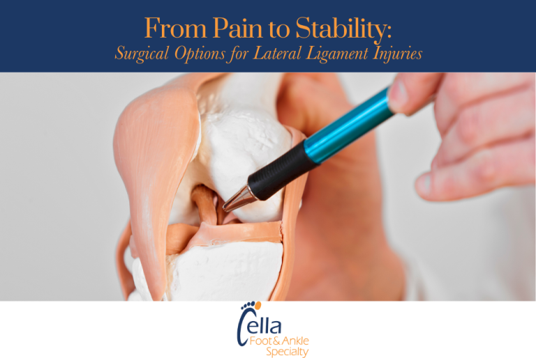 From Pain to Stability: Surgical Options for Lateral Ligament Injuries ...