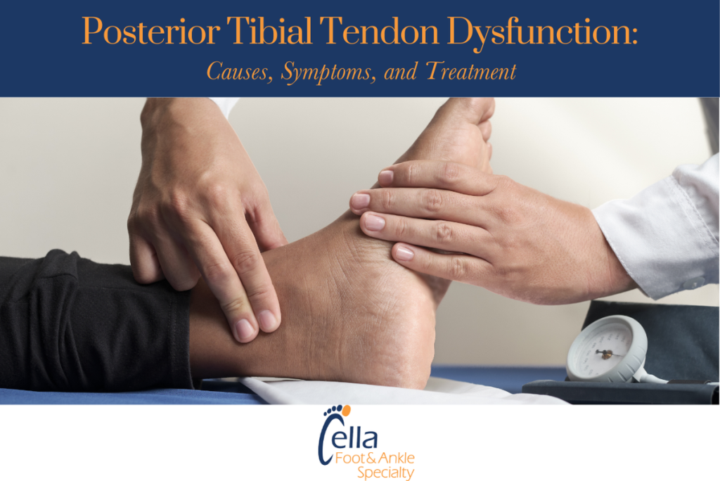 Posterior Tibial Tendon Dysfunction: Causes, Symptoms, and Treatment ...