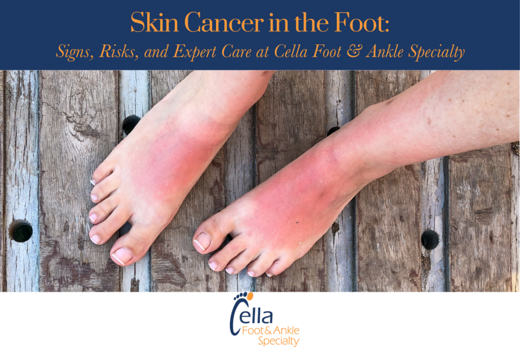 Skin Cancer in the Foot: Signs, Risks, and Expert Care at Cella Foot ...