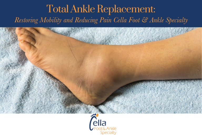 Total Ankle Replacement: Restoring Mobility and Reducing Pain | Cella ...