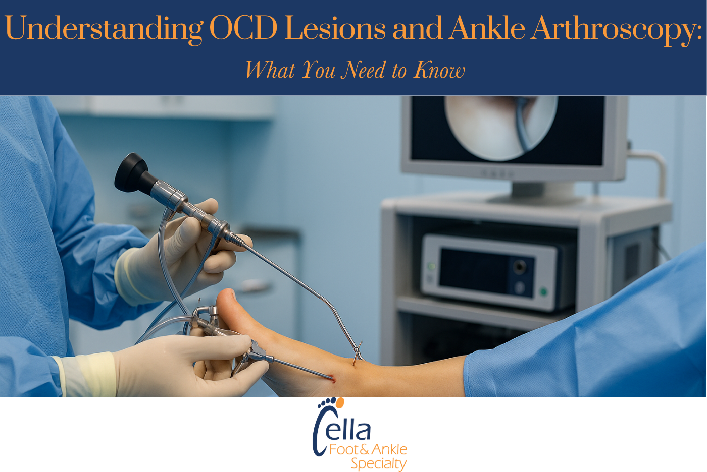 Understanding OCD Lesions and Ankle Arthroscopy: | Cella Foot & Ankle ...